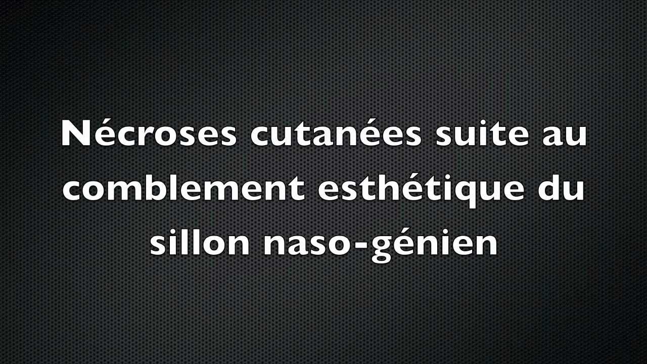 UE anatomie - Nécrose cutanée post injection dans le sillon naso-génien ...