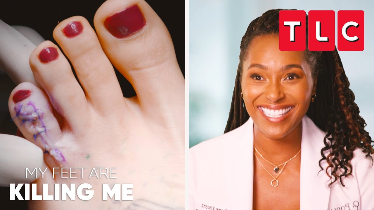 Dr. Vincent’s Most Incredible Moments | My Feet Are Killing Me | TLC ...