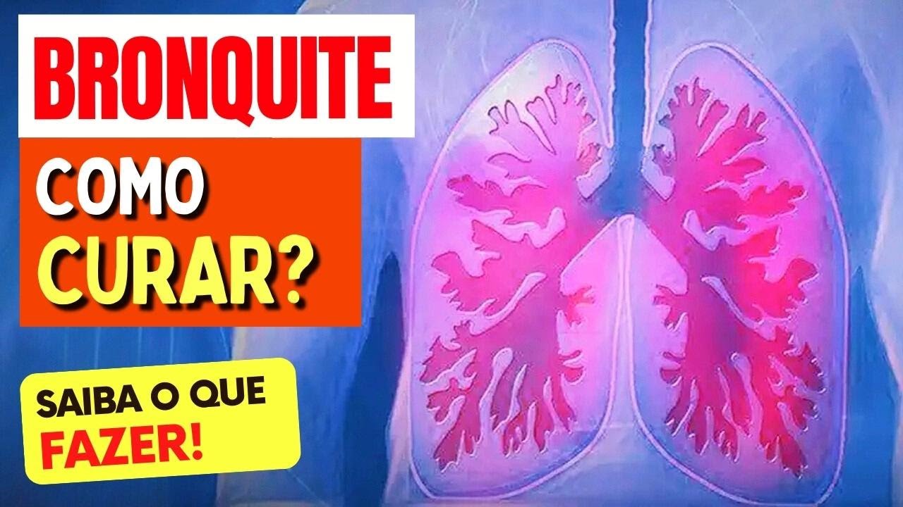 BRONQUITE - COMO CURAR? O que você PRECISA SABER! - YouTube