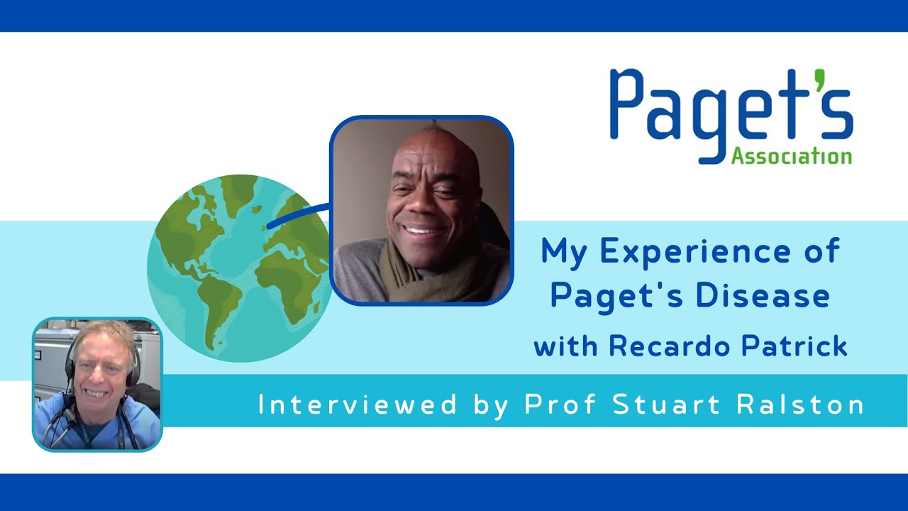 Mr Recardo Patrick explains his experience of Paget's Disease of Bone ...