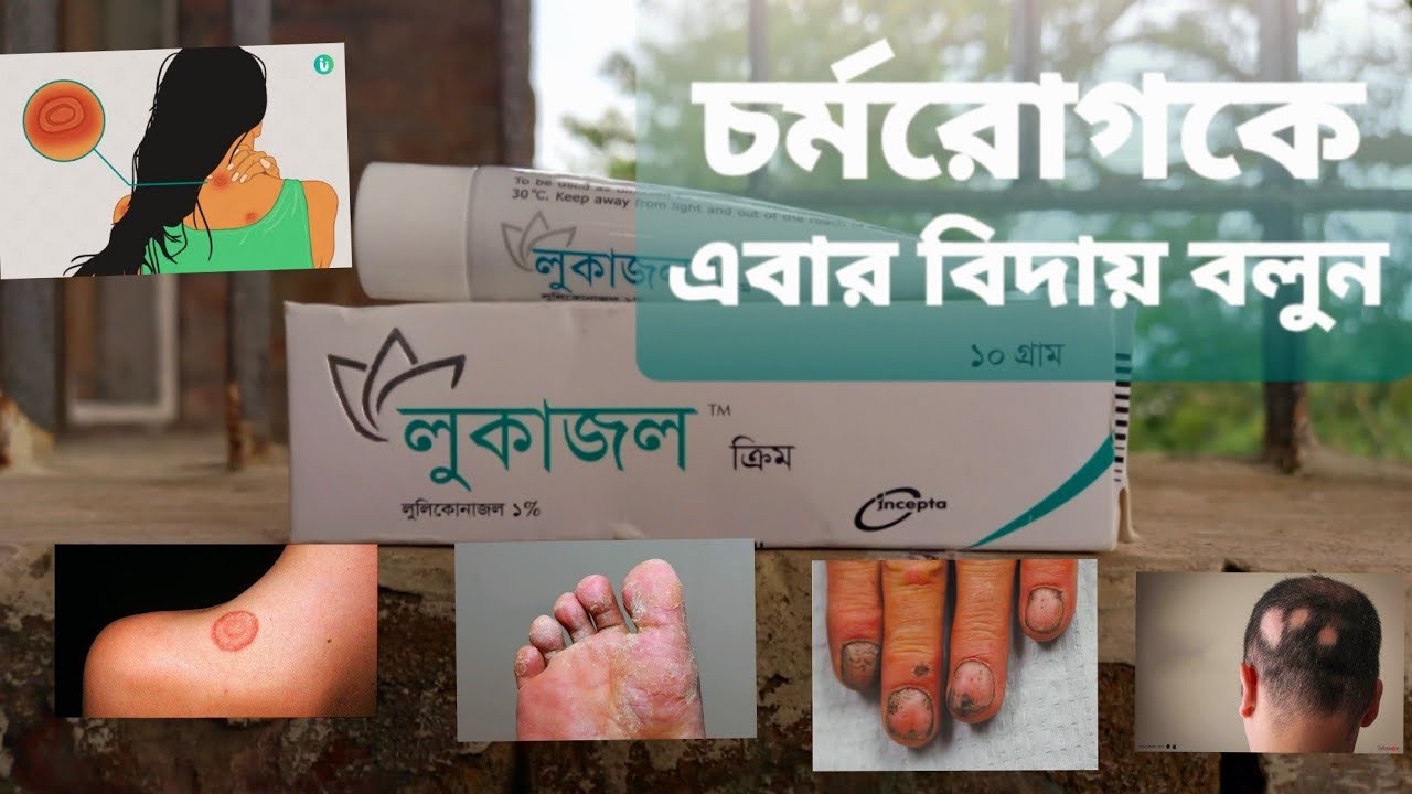 লুকাজল ক্রিম |Lucazol Cream| চর্মরোগের সব থেকে কার্যকরী ক্রিম - YouTube