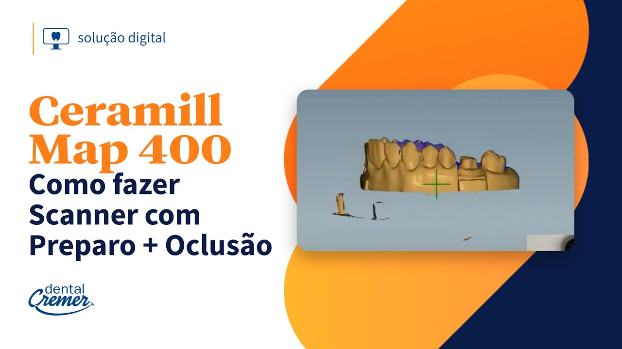 Ceramill Map 400 - Como fazer Scanner com Preparo + Oclusão - YouTube