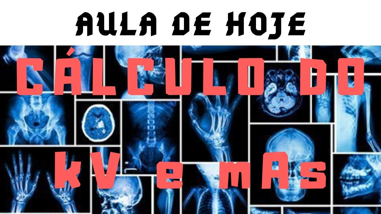 Tabela Pronta De Kv E Mas - BRAINCP