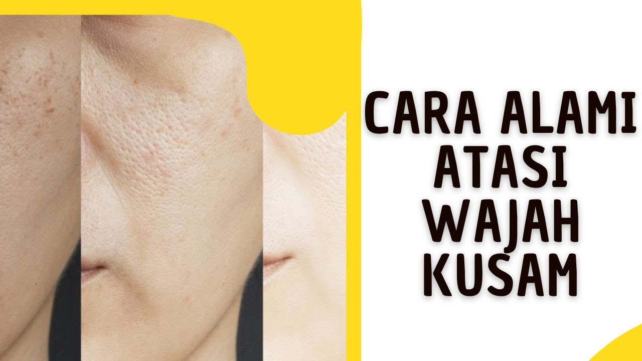 Wajah Sering Kusam? Lakukan Perawatan Alami Ini - YouTube