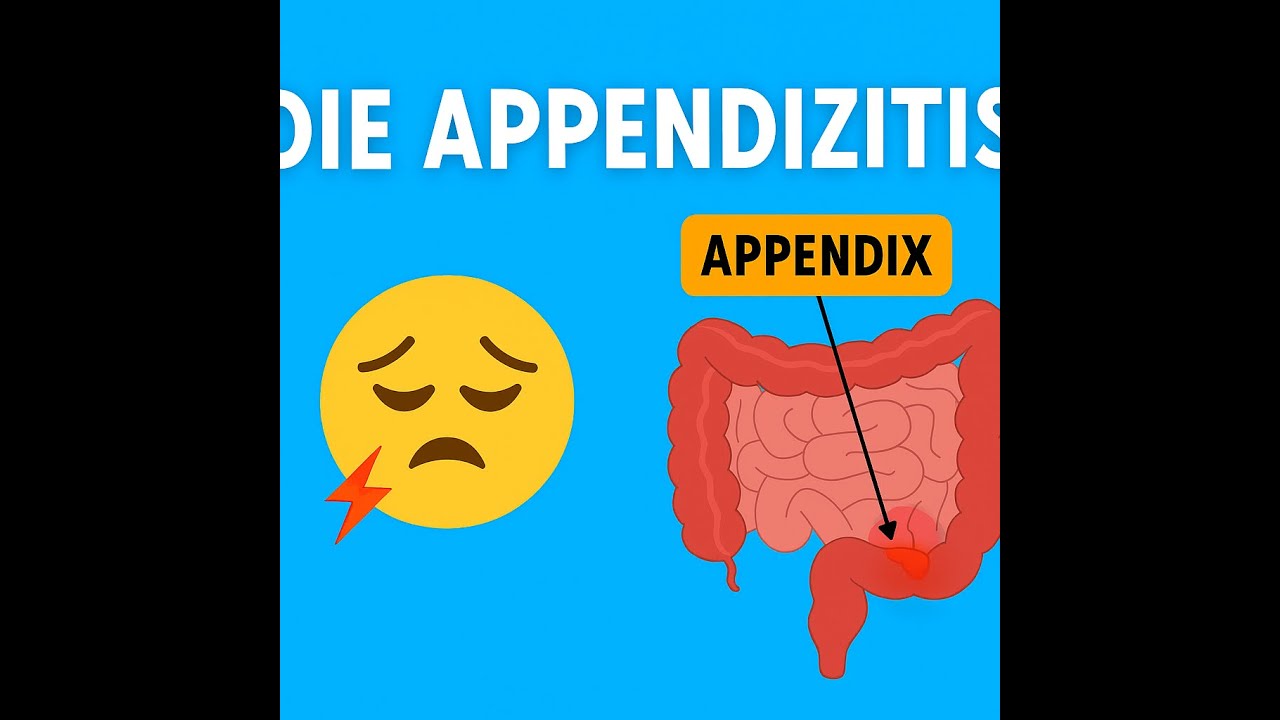 Die Blinddarmentzündung/Die akute Appendizitis: Symptome, Verlauf und ...