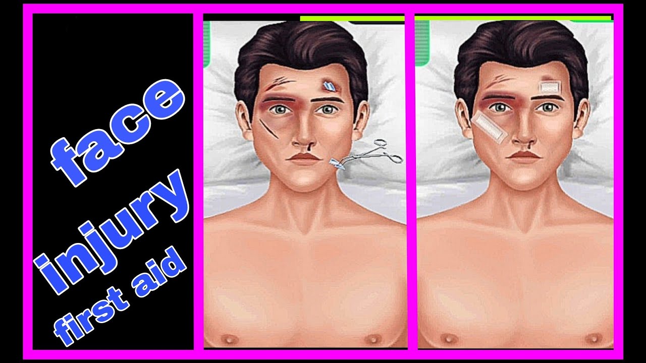 ASMR face injury treatment first aid ⛑️ animation - YouTube