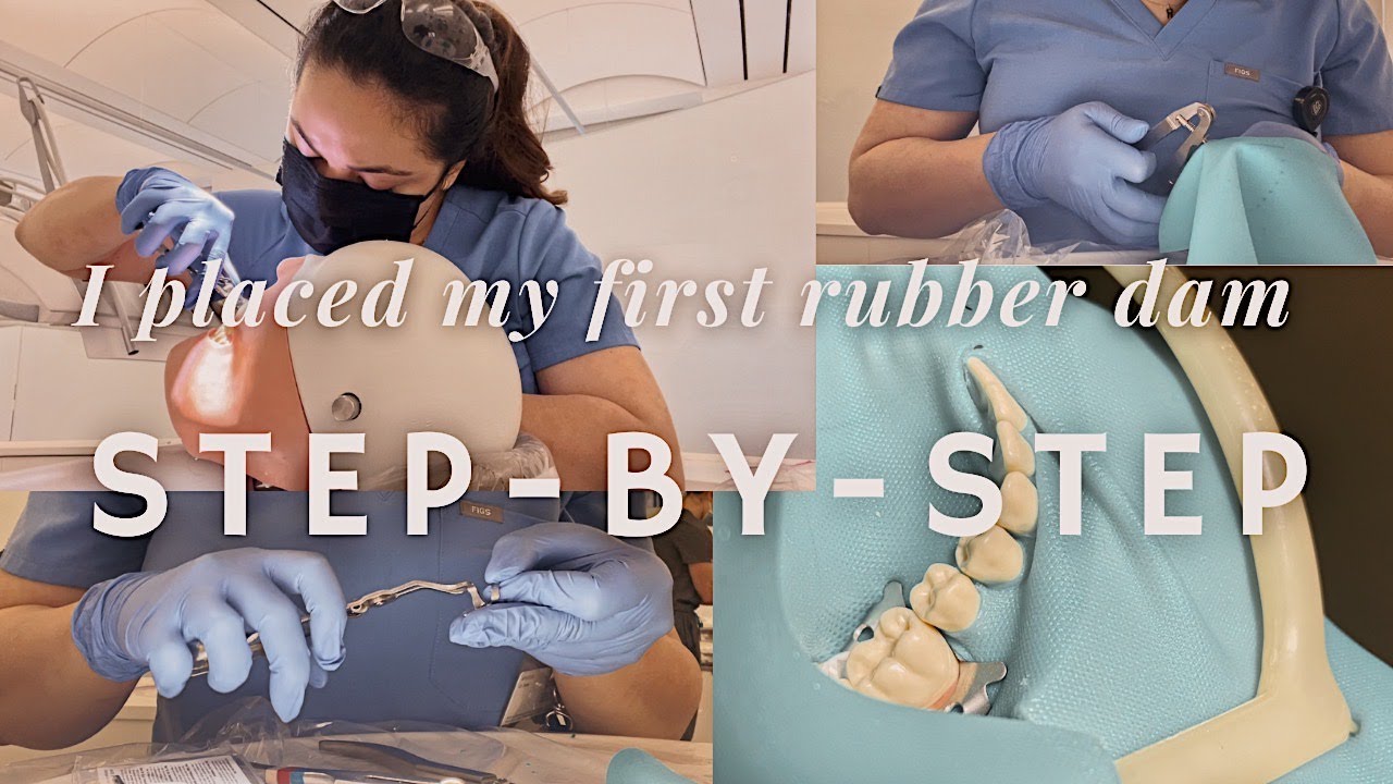 Placing my first rubber dam - Step-By-Step Guide (from a beginner ...