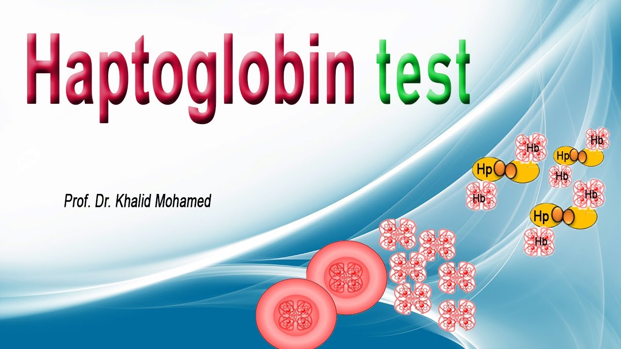 Haptoglobin Test تحليل هابتوجلوبين - YouTube