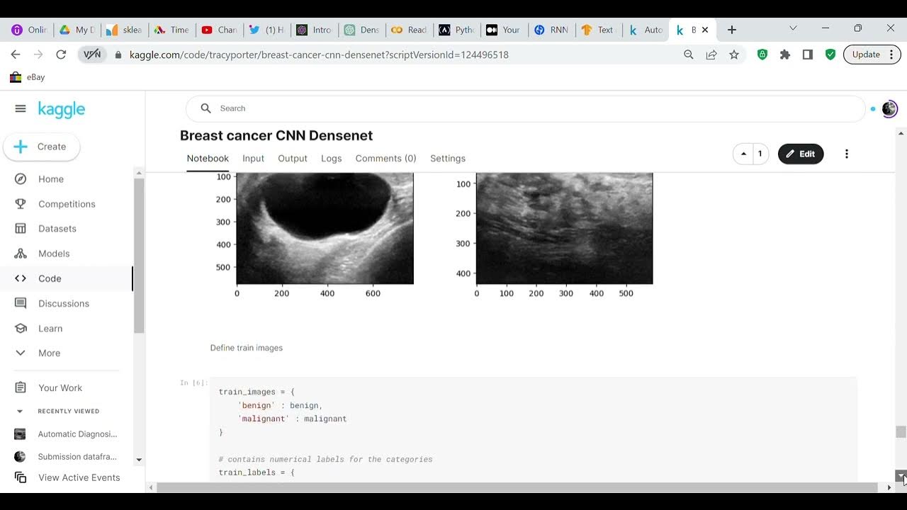 Code Review: Kaggle community competition on Breast cancer ultrasound ...