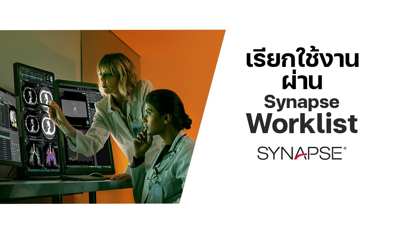 2 การใช้งานผ่าน Synapse Worklist - YouTube