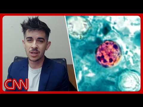 Diarrhea parasite cyclospora victim describes initial symptoms