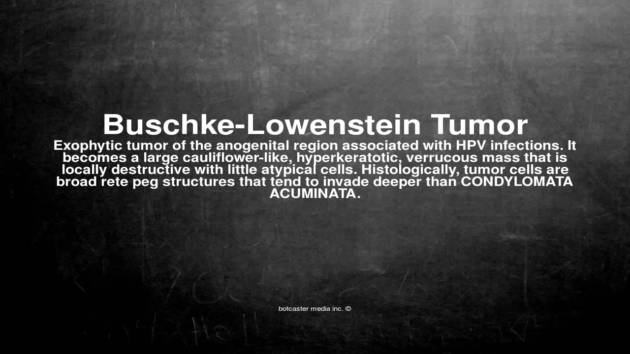 Medical vocabulary: What does Buschke-Lowenstein Tumor mean - YouTube
