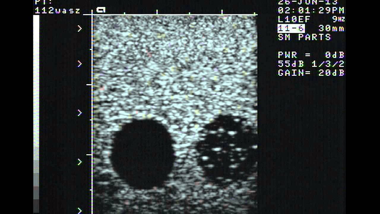 Siemens Acuson 128XP - L10 - głowica USG - YouTube