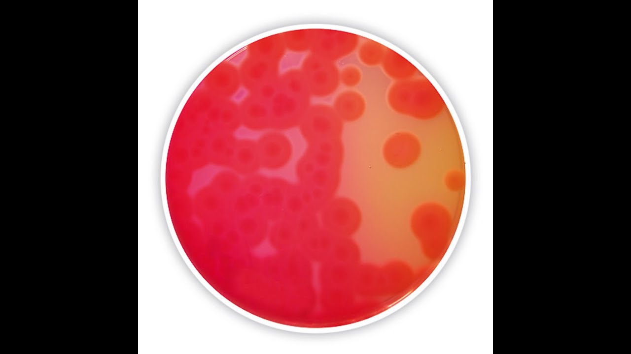 Contagem de Bacillus cereus - YouTube