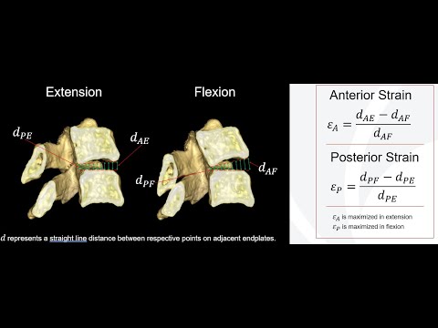 Introduction to use of strain to diagnose of pseudarthrosis following ...