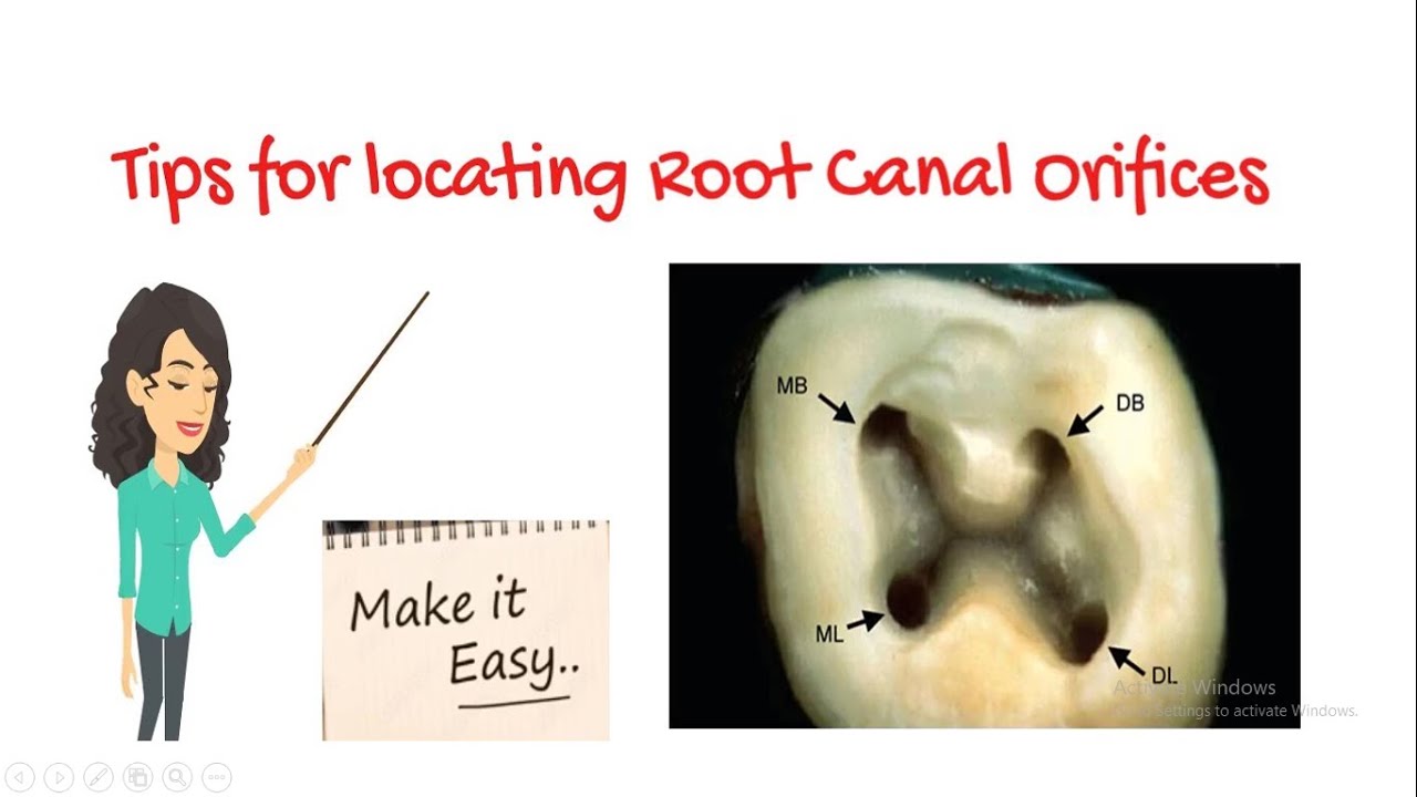 How to locate Root Canal Orifices I Krasner and Rankow Laws I NEET MDS ...