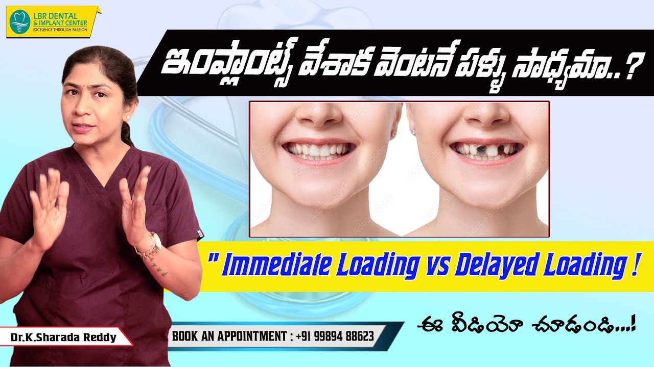 The Shocking Truth About Immediate Loading VS Delayed Loading Implants ...