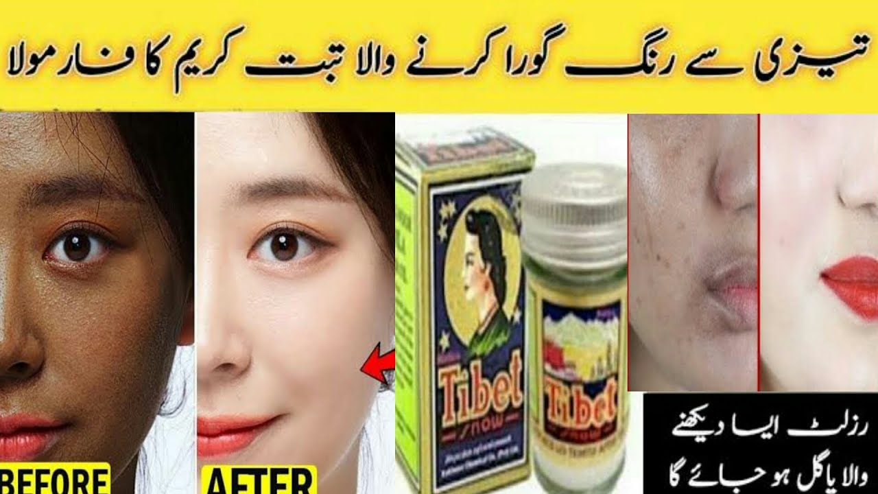 Add Just 1 thing With "TIBET SNOW CREAM" And Get Full Fairness ️|Tibet ...