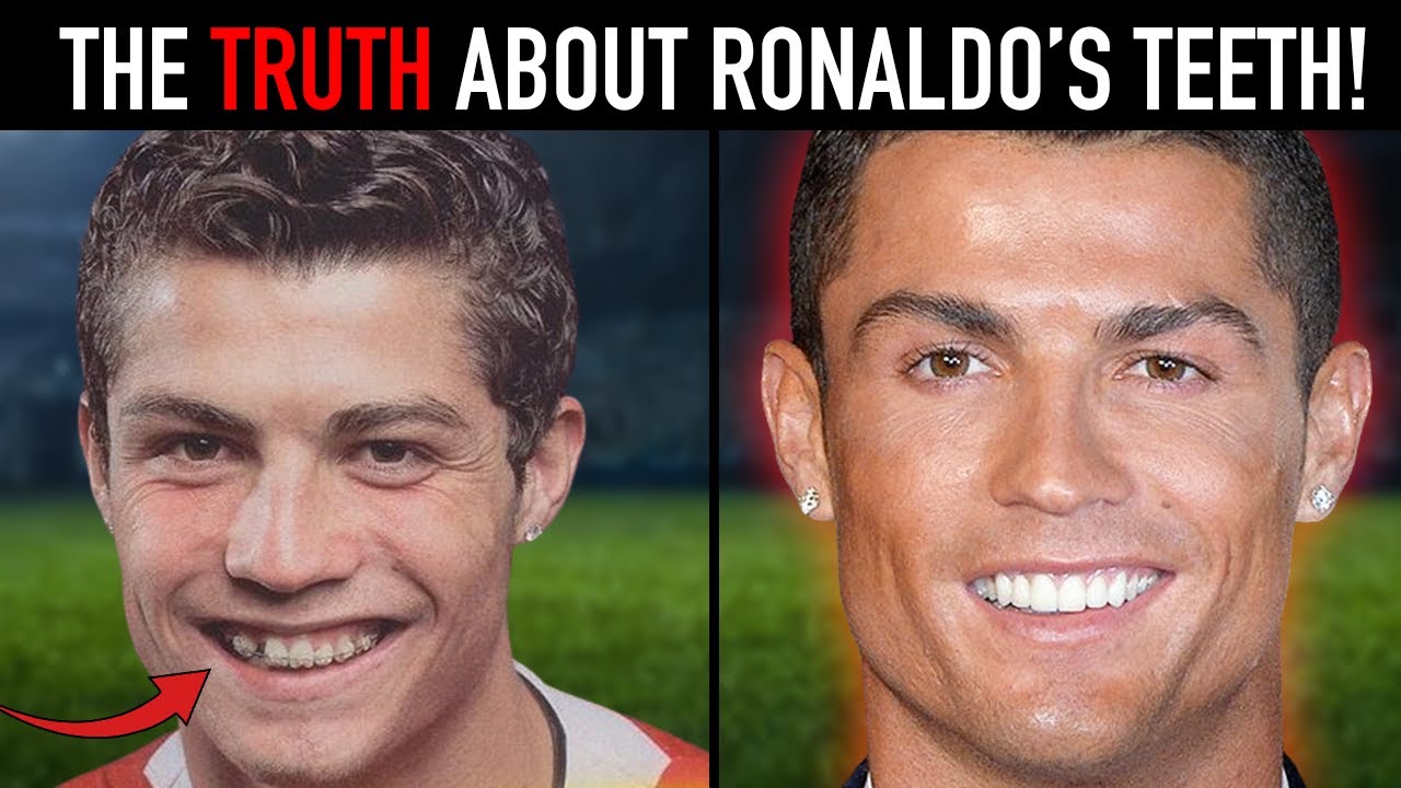 Cristiano Ronaldo Amazing Teeth Transformation - Whats the secret ...