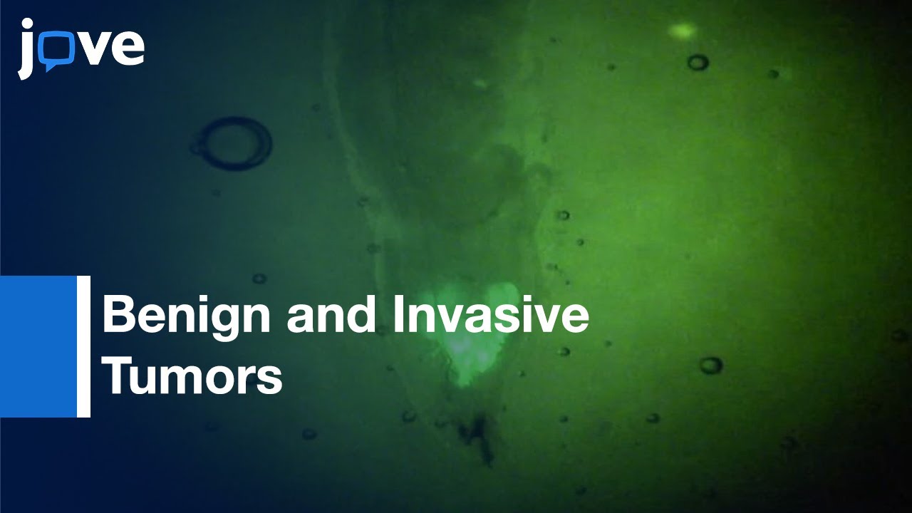 Benign and invasive Tumors: Induction and Visualization | Protocol ...