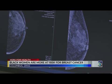 Study shows Black women more at risk for breast cancer