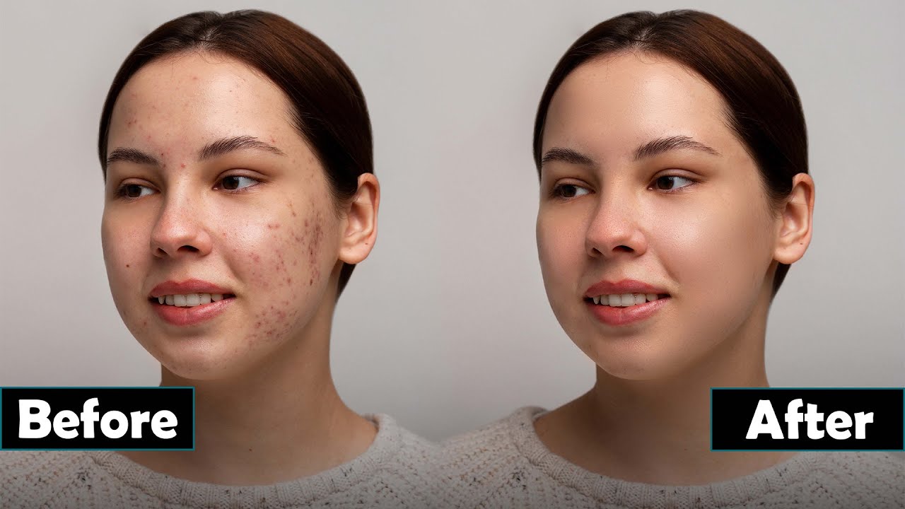 Face Retouching for Beginners | Acne Removal & Skin Smoothing in ...