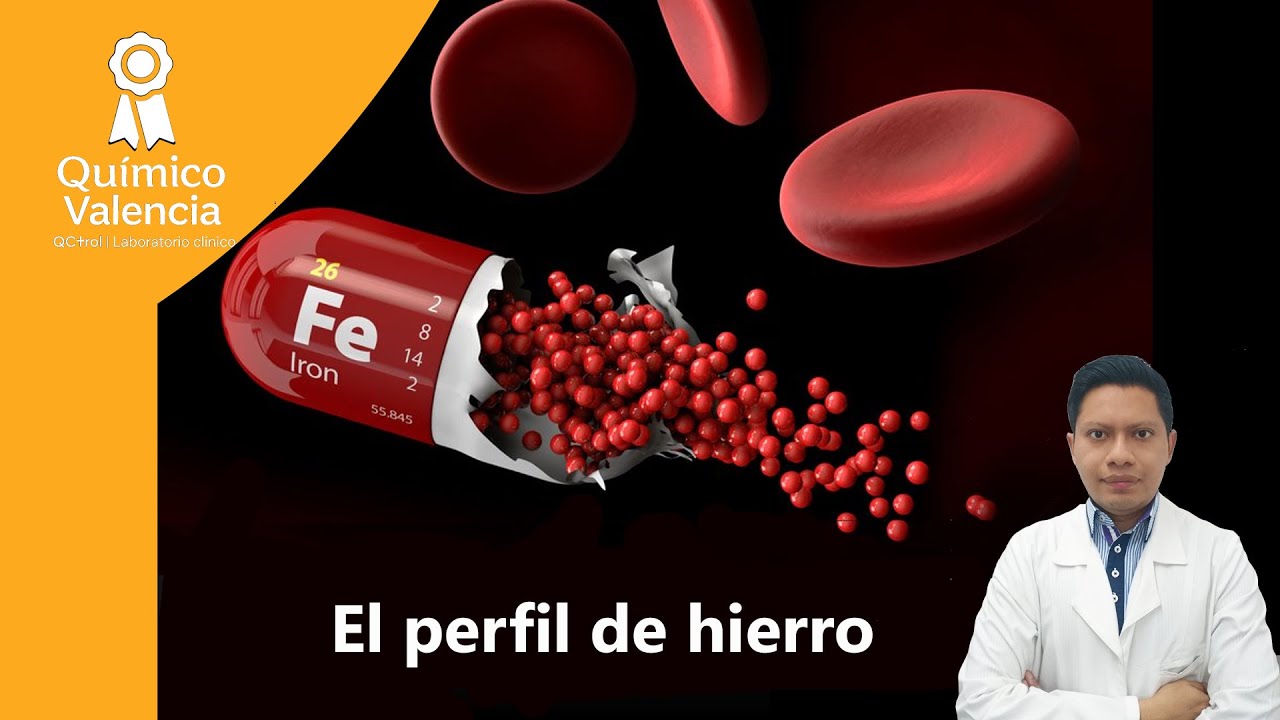 ¿Para qué sirve el PERFIL DE HIERRO? - YouTube