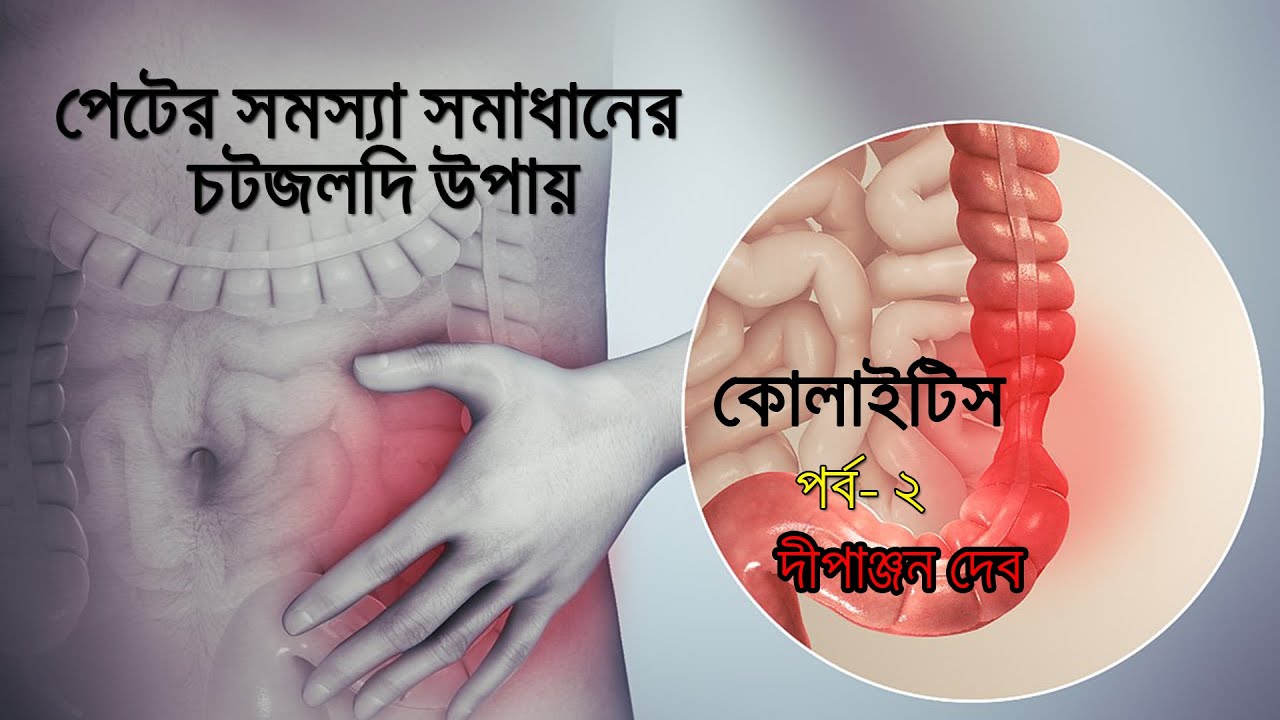 #Colitis pain relief at home|| শিখেনিন সবচেয়ে সহজ পদ্ধতি || - YouTube