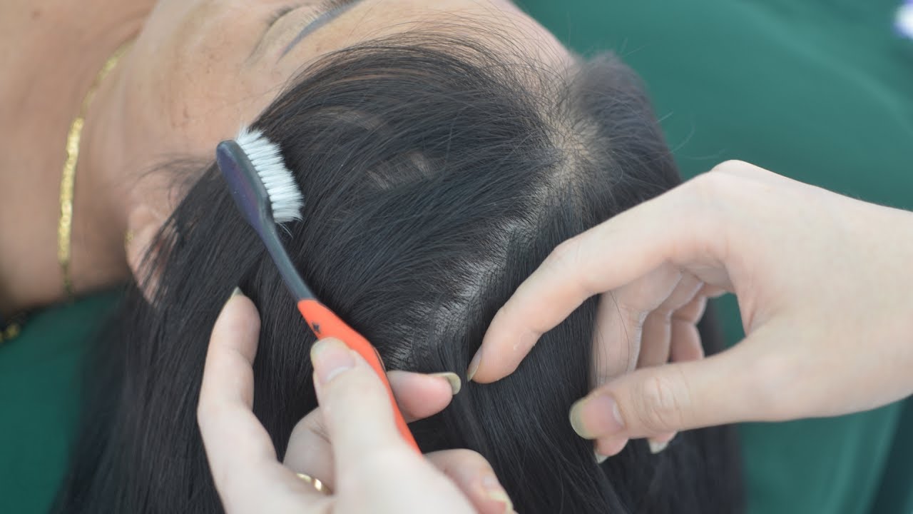 ASMR Scalp Scratch, Hair Combing, Hair Parting, Toothbrush, Hair Tingly ...