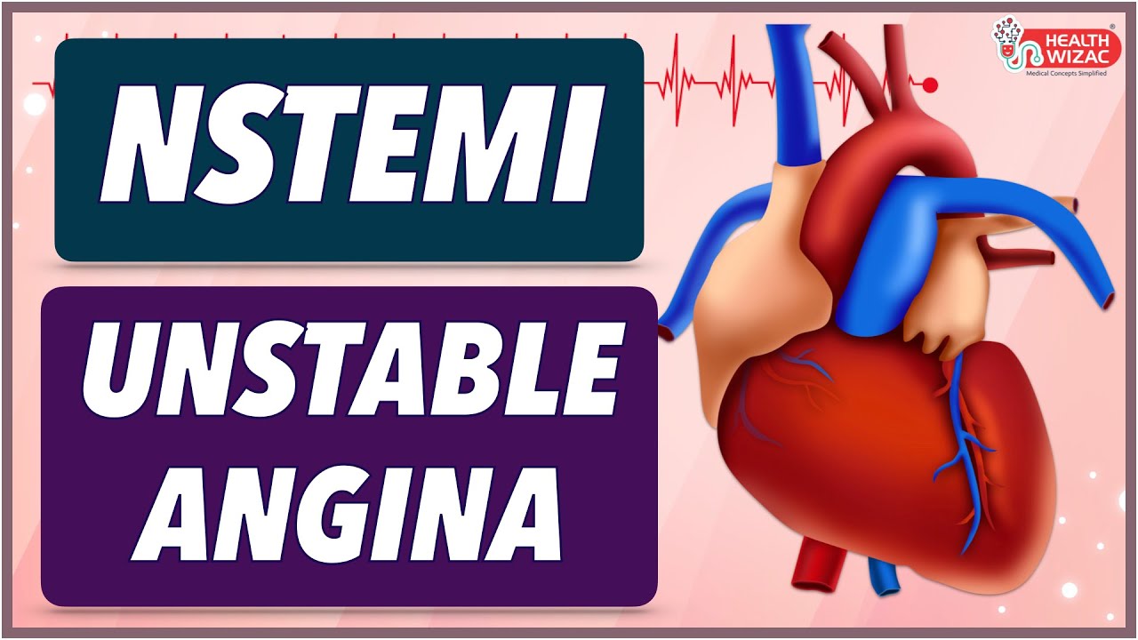 NSTEMI AND UNSTABLE ANGINA SIMPLIFIED | UNDERSTANDING NSTE-ACS - YouTube