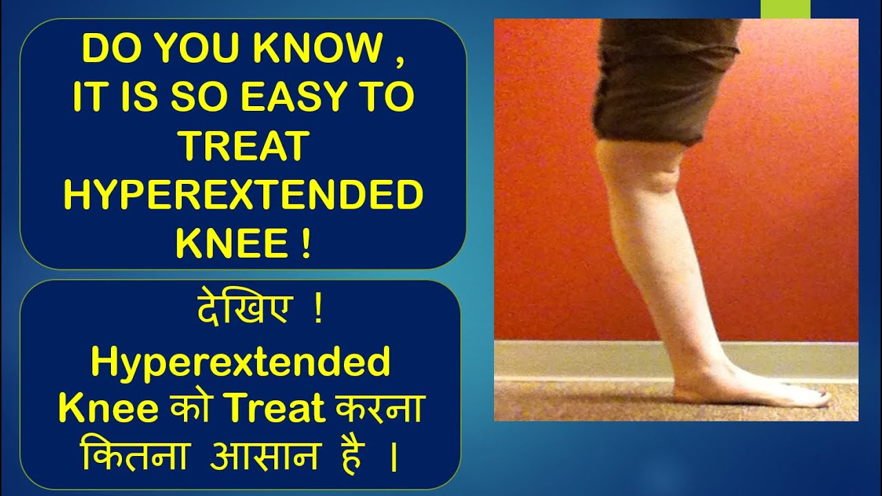 TREAT YOUR HYPEREXTENDED KNEE EASILY - YouTube