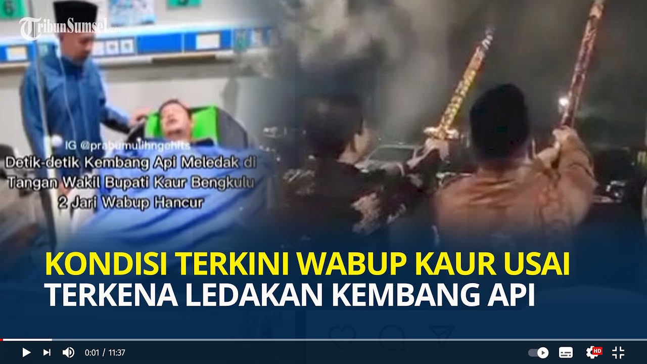Kondisi Terkini Wabup Kaur Bengkulu Herlian Muchrim Usai Jari Tangan ...