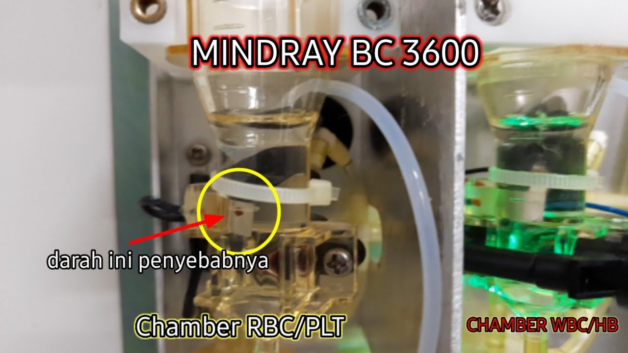 hematologi Mindray bc 3600 background abnormal #backgroundabnormal # ...