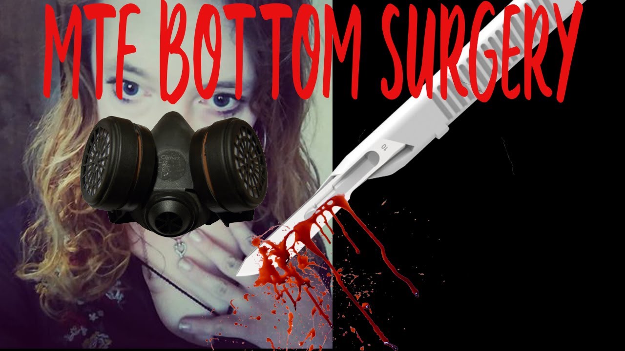 MtF Bottom Surgery (Male to Female Bottom Surgery Prep for Transgenders ...