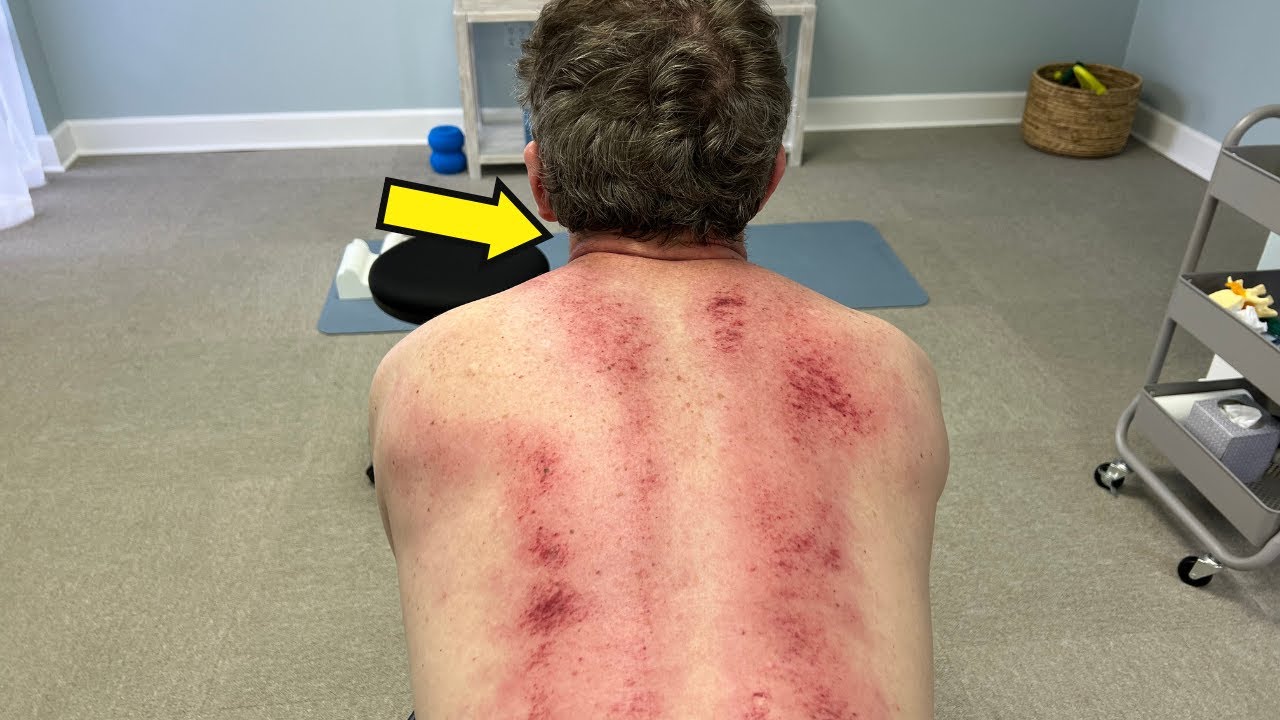 Freeing A FROZEN Neck 🙌🏻 Crunches & Intense Massage Release Neck & Back ...