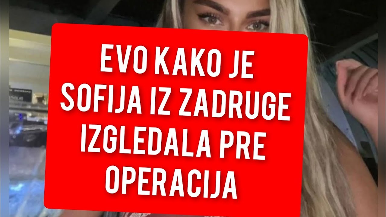 OVE SLIKE BI ZAPALILA DA MOZE - EVO KAKO JE IZGLEDALA SOFIJA PRE OPERACIJA - YouTube