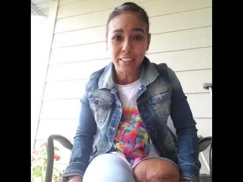 My amputee story PART 1 - why I had TWO amputations within 3 months ...