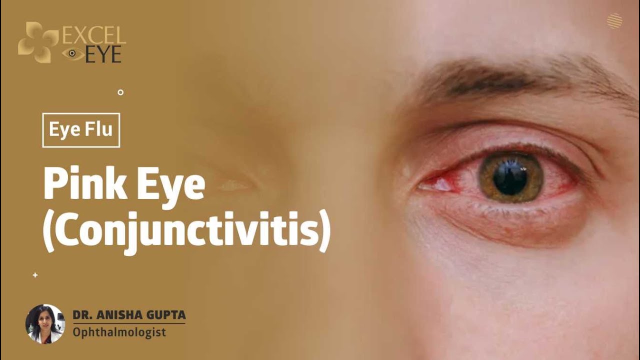 Pink Eye (Conjunctivitis) | Eye Flu | Causes, Symptoms, Treatment ...