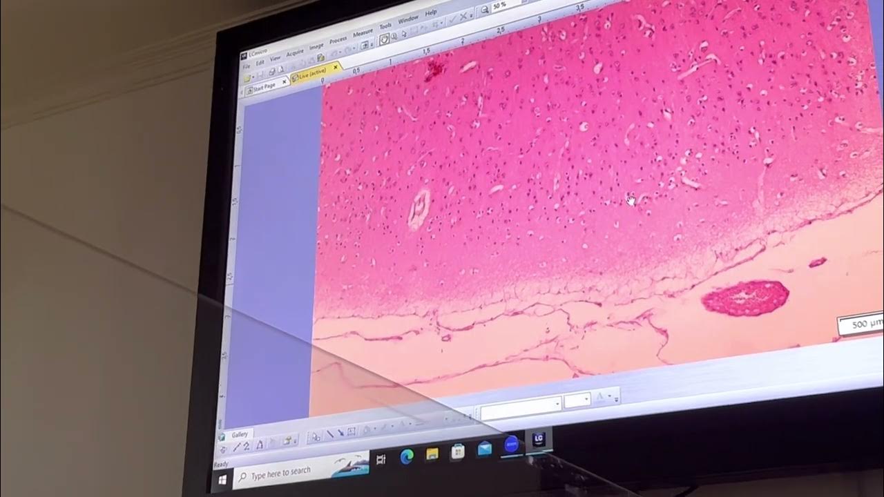 Histologi Otak Besar Cerebrum Blok Sistem Saraf Semester 2 Youtube