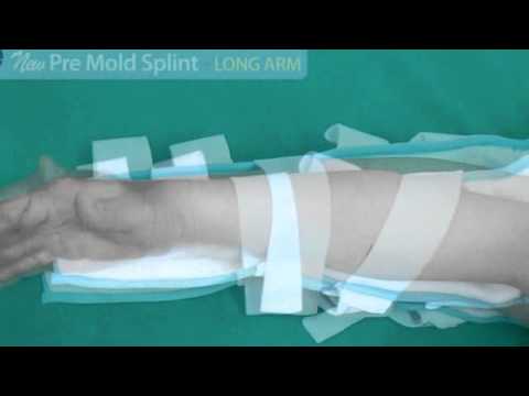 New Pre-mold Splint-No water necessary-Hard as rock-Velcro Strapping ...