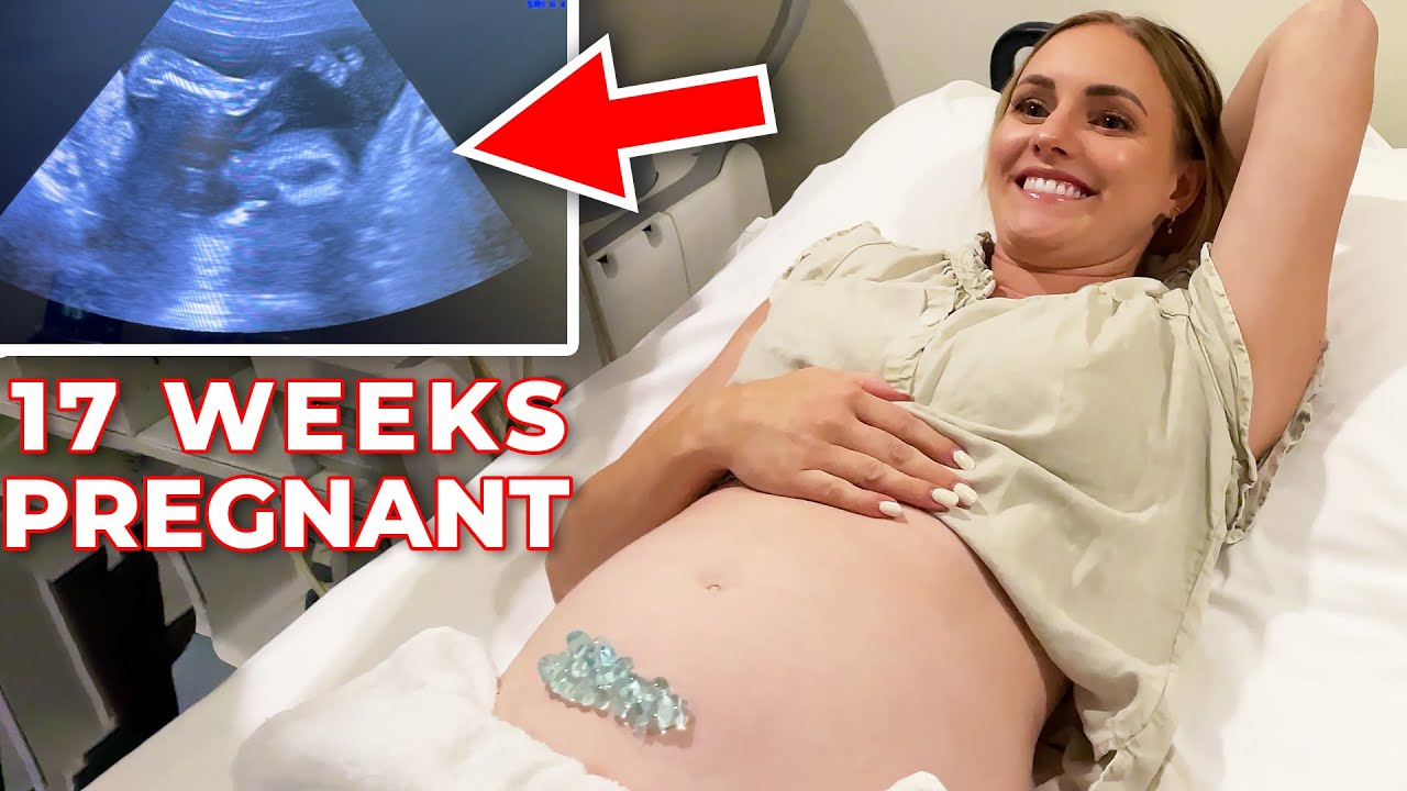17 WEEK ULTRASOUND! How Does This Keep Happening? 😫 - YouTube
