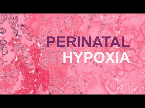 Perinatal Hypoxia - YouTube