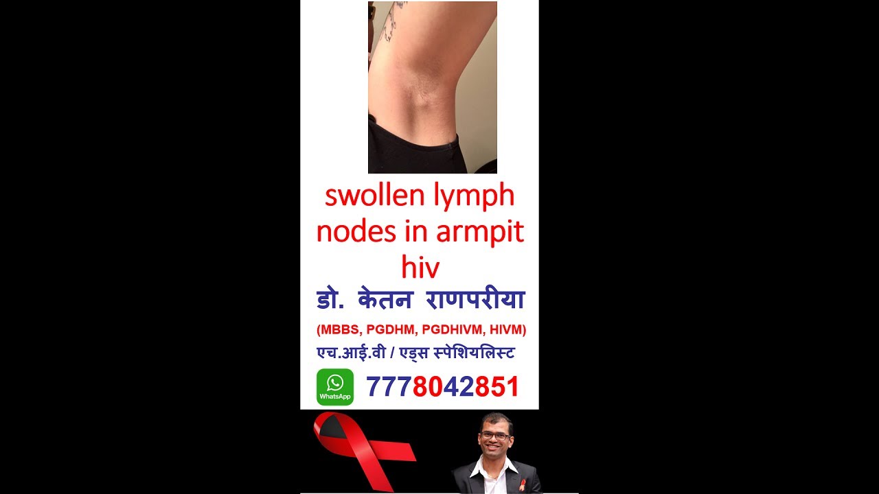 Lymph Nodes Armpit Hiv 9080