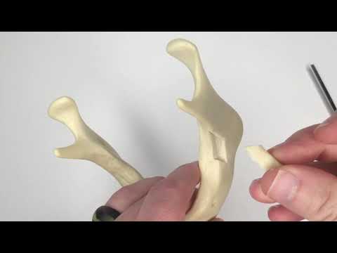 Hero Dental Implants - Frank Zastrow's take on Khoury Plate Technique ...