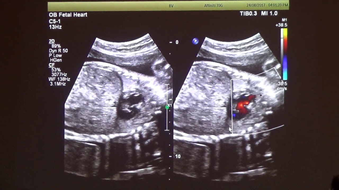 Live scan 2 - YouTube