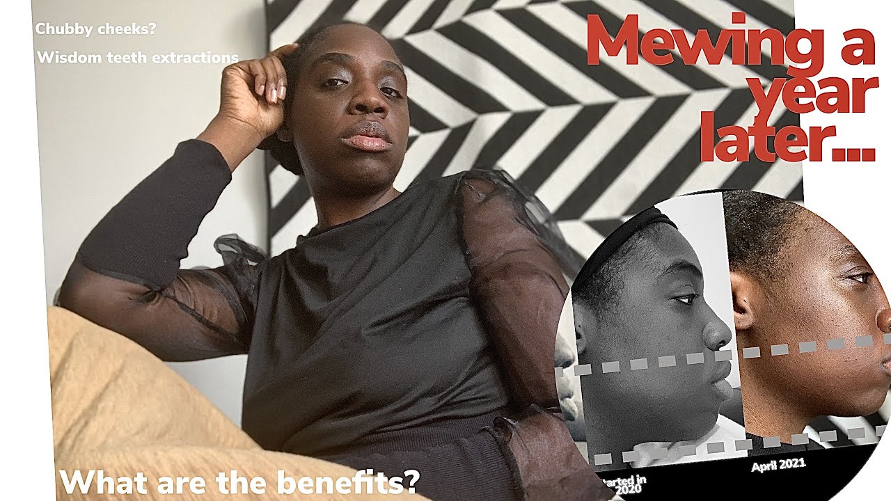 One year of mewing, my experience so far.... - YouTube
