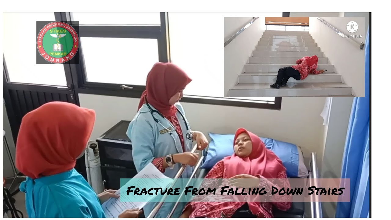 Fracture From Falling Down Stairs - YouTube