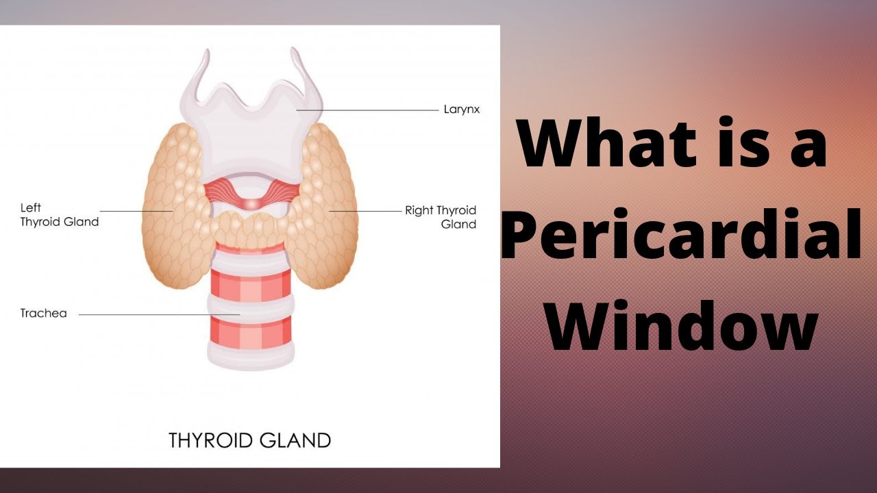 What is a Pericardial Window - YouTube