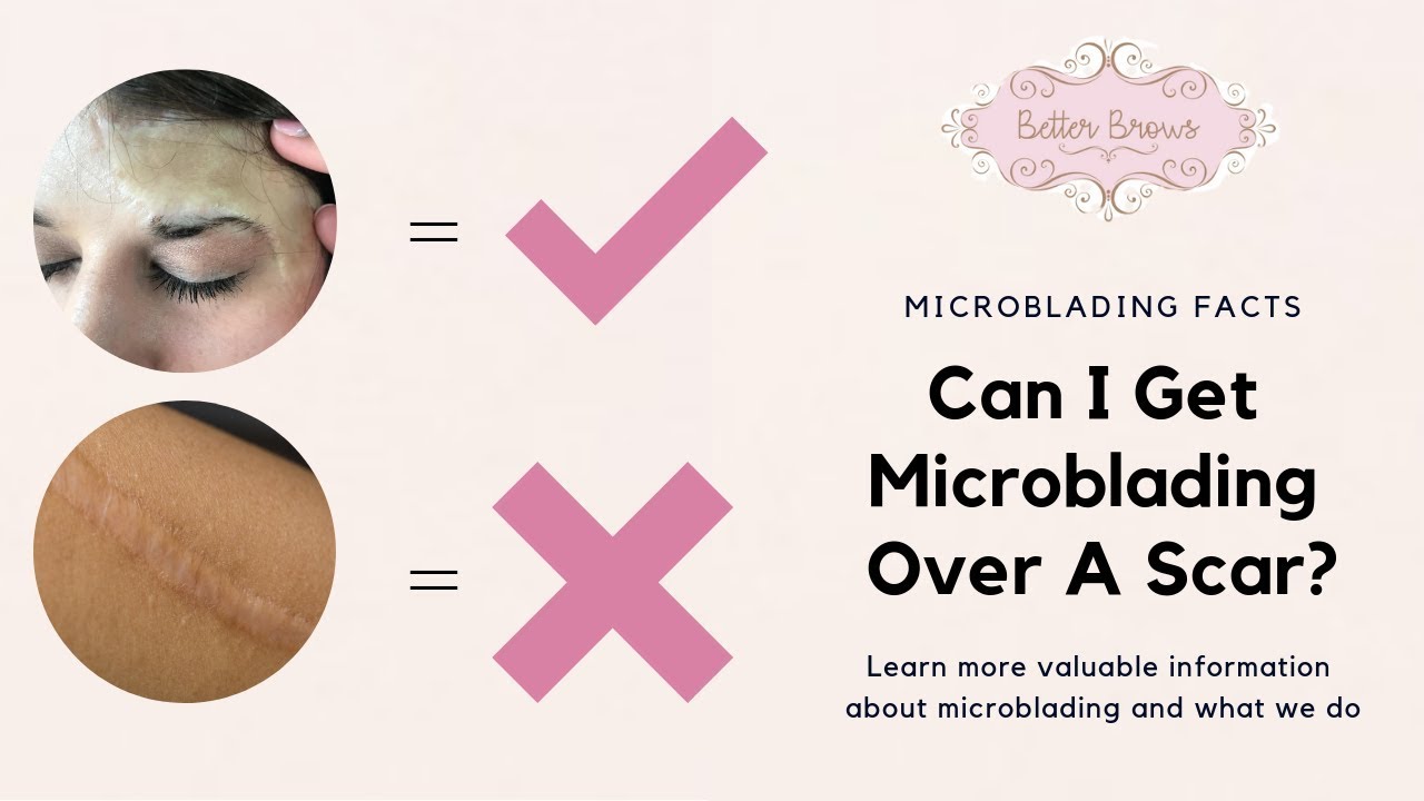 Can I Get Microblading Over A Scar? - YouTube