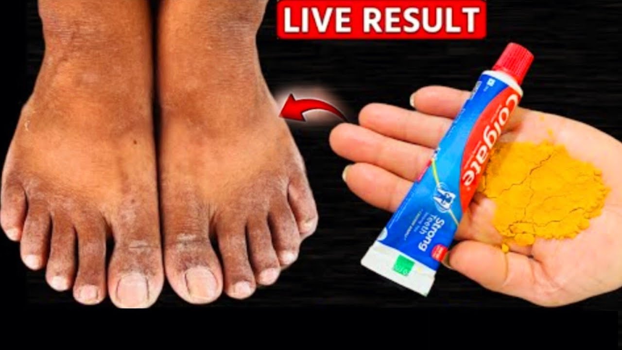 A1 Mani & Pedicure 100%💖Touching| Feet & Hand Brightening colgate| Tan ...
